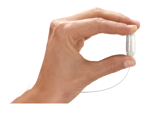 Obalon Non Surgical Weight Loss Balloon Fort Worth Plano TX